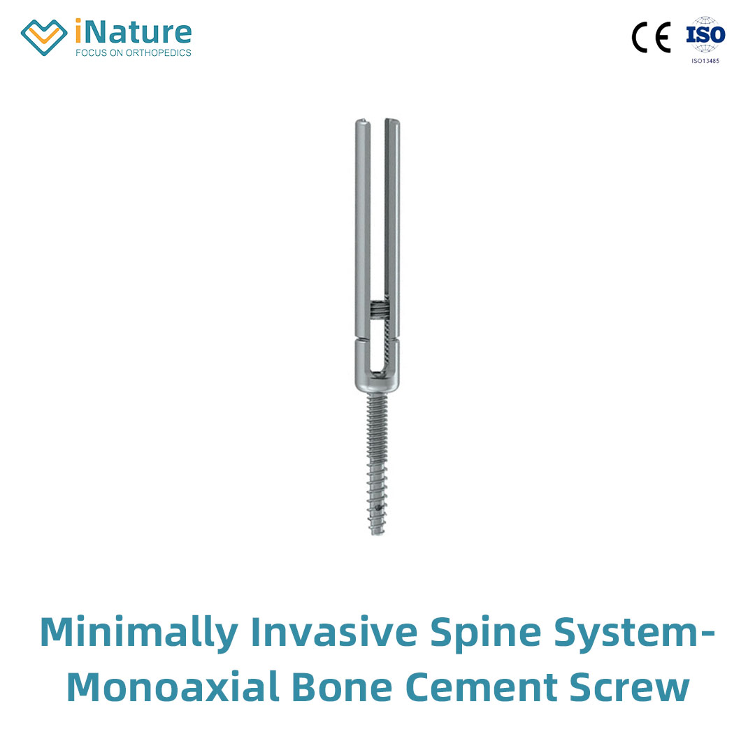 Minimally Invasive Spine System-Bone Cement Screw-| iNature ...
