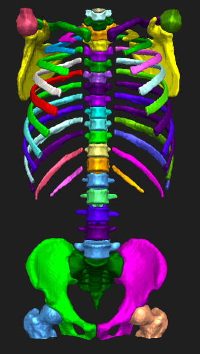 CT医学影像三维重建服务-位姿科技