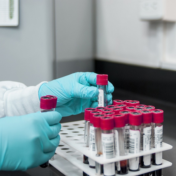 降钙素原测定试剂盒:准确检测的健康卫士_上海康元科技发展股份有限公司