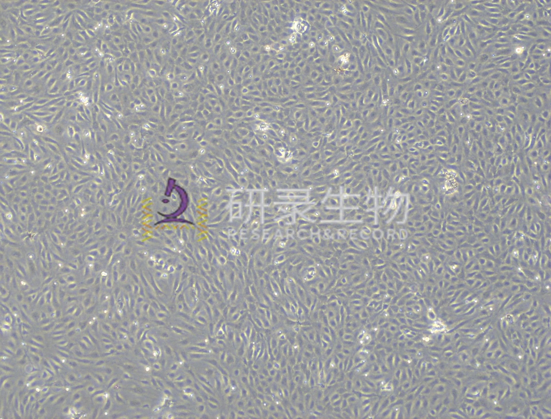 HUVEC(人脐静脉内皮细胞)-上海研录生物医药有限公司
