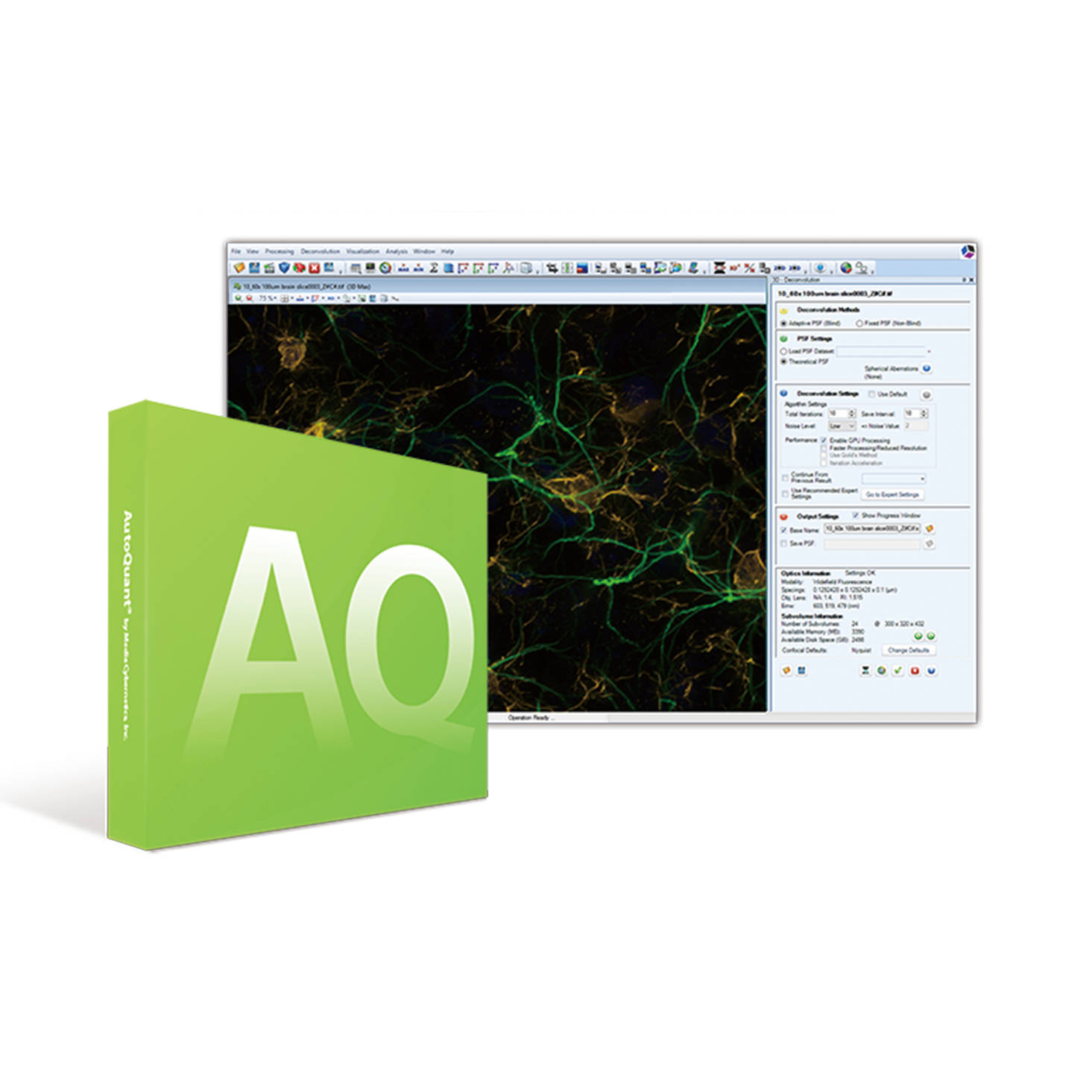 AutoQuant X3 去卷积三维重构软件_广州市元奥仪器有限公司