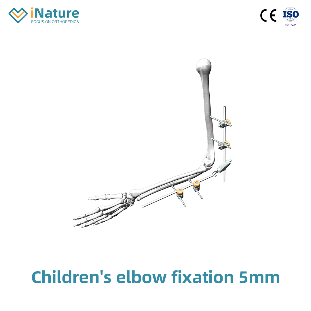 Cross Elbow Spanning External Hinged Movement Fixator-Inature