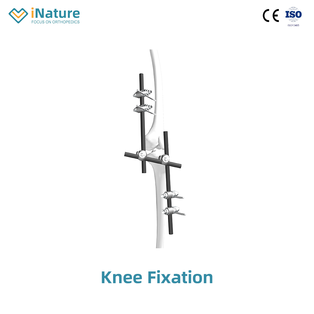 Φ11 0 Series External Fixation Fixator Inature Manufacturer And Sale