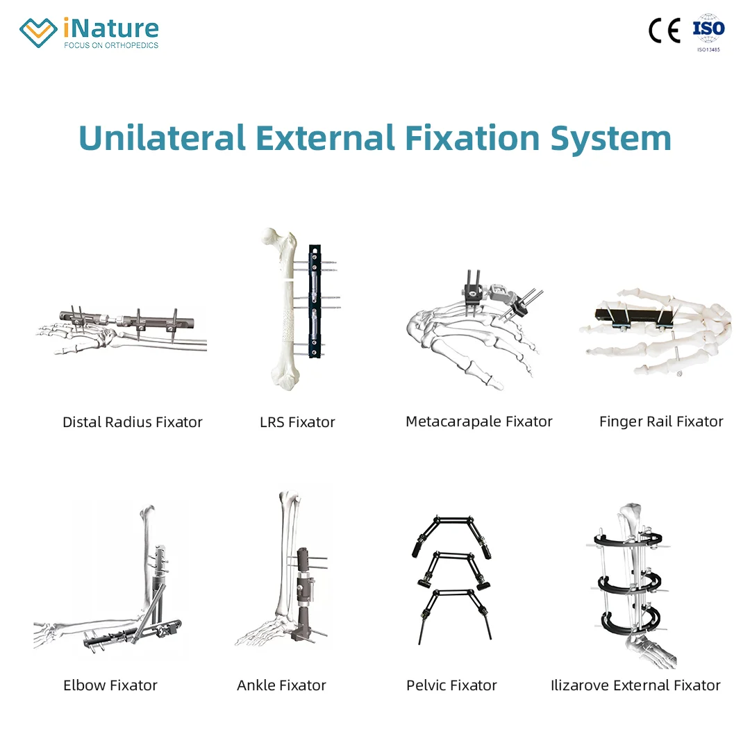 Unilateral External Fixation System-| iNature - Manufacturer & Sale