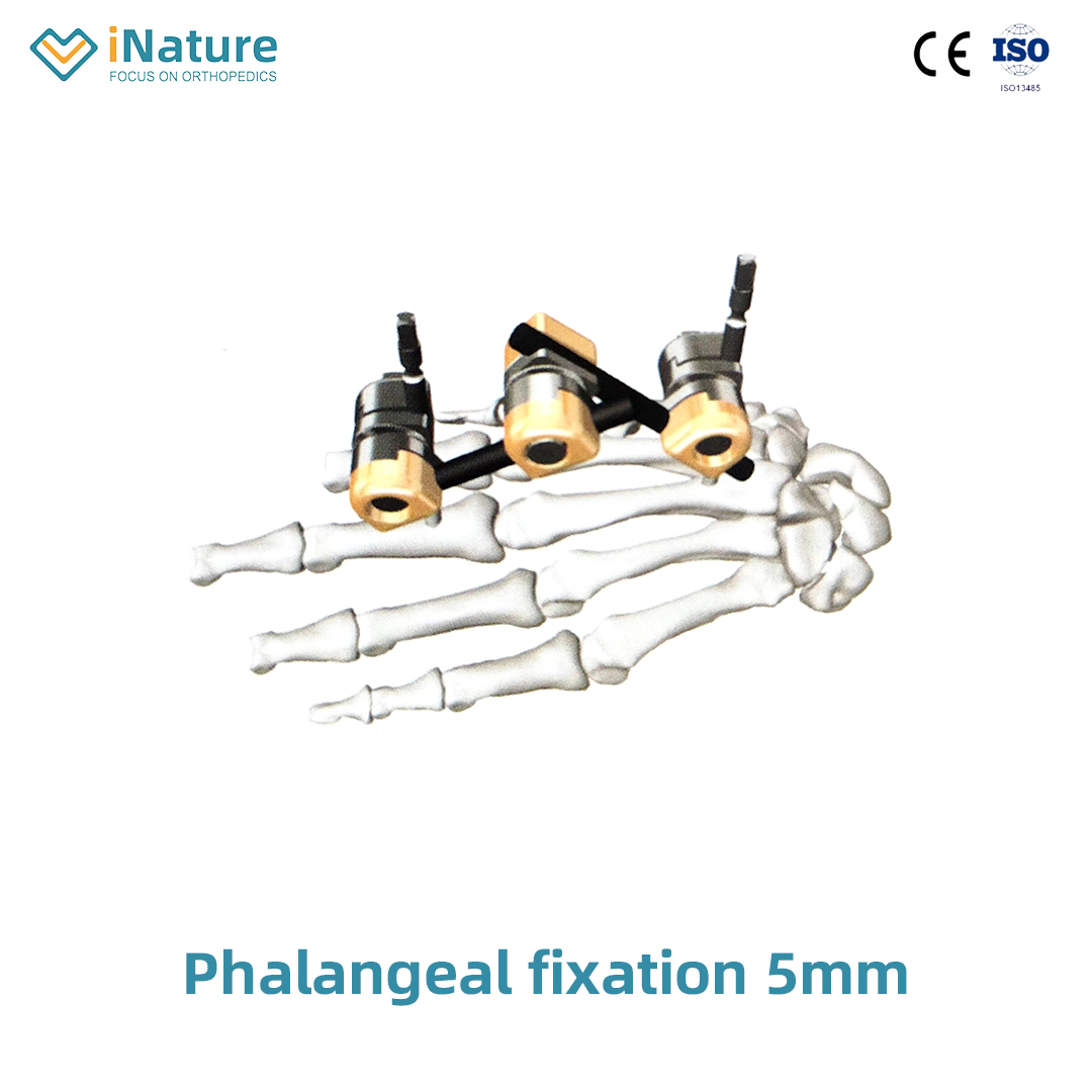 Φ5.0 Series External Fixation Fixator-| iNature - Manufacturer & Sale