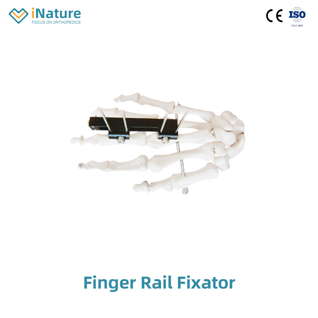 Wrist And Hand External Fixation Factory/Surgery-Inature