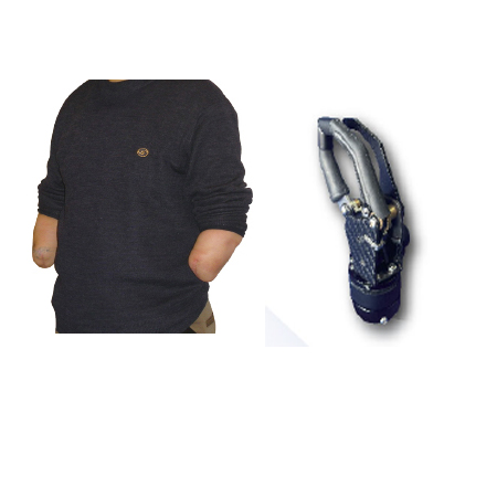 Electric Hand With Two Degrees of Freedom (W rist Rotation )