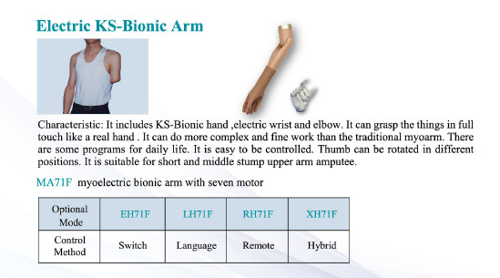 Electric KS-Bionic Arm