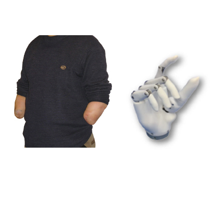 Electric KS-Bionic Hand-Shanghai Kesheng Prosthetic Technology Co., Ltd.