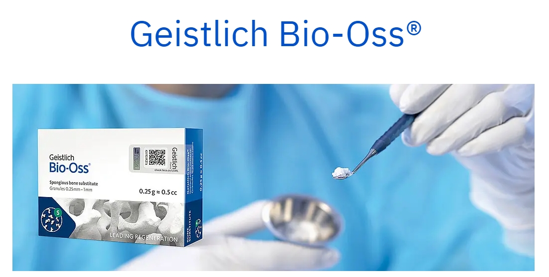 你是否在种植时候用了进口的骨粉？那很有可能是用了瑞士盖氏的骨粉.盖氏经典产品 Geistlich Bio-Oss® 是口腔骨再生领域中被全球 ...