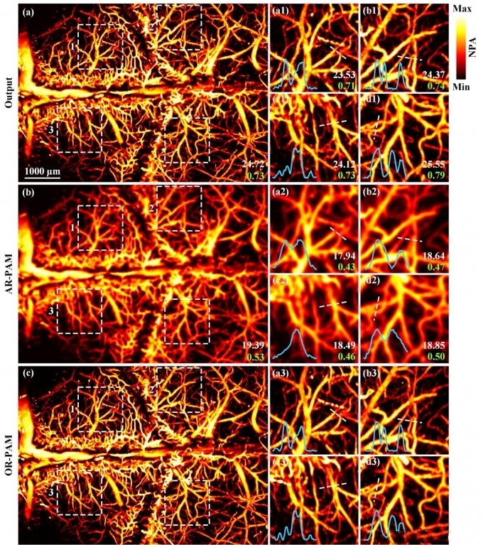 南昌大学在声学分辨率光声显微成像增强方面研究获得进展_东方闪光(北京)光电科技有限公司