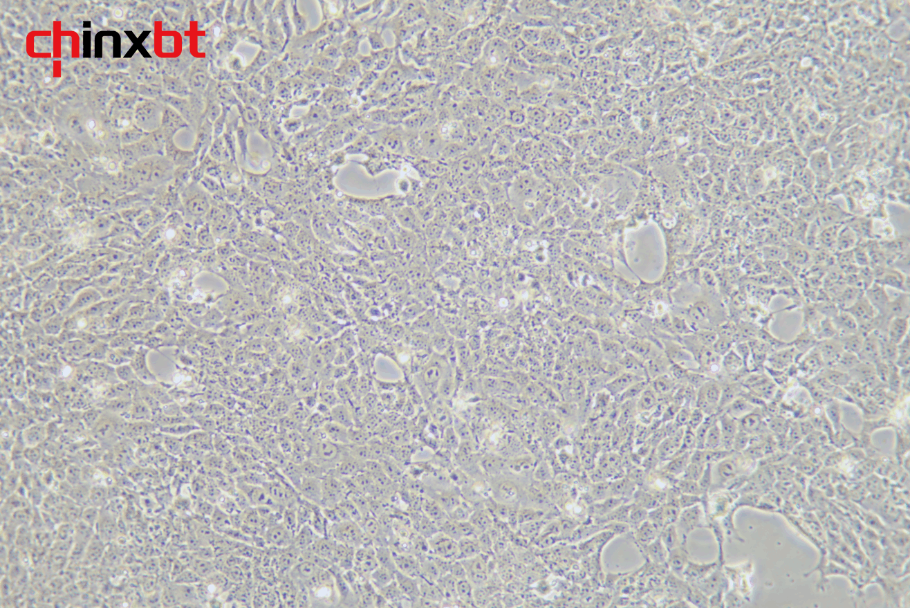 4T1 小鼠乳腺癌细胞_南京中欣博泰生物技术有限公司