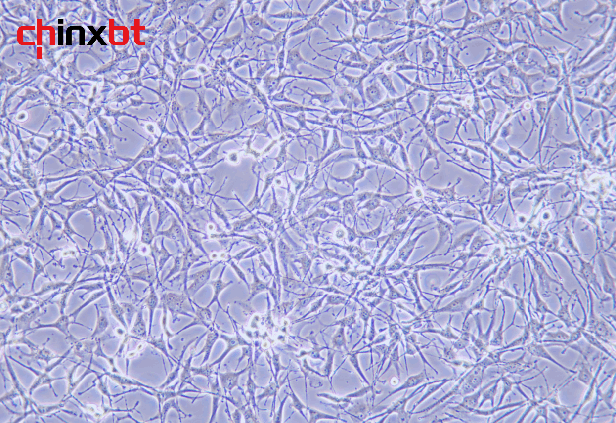 A172 人胶质母细胞瘤细胞_南京中欣博泰生物技术有限公司