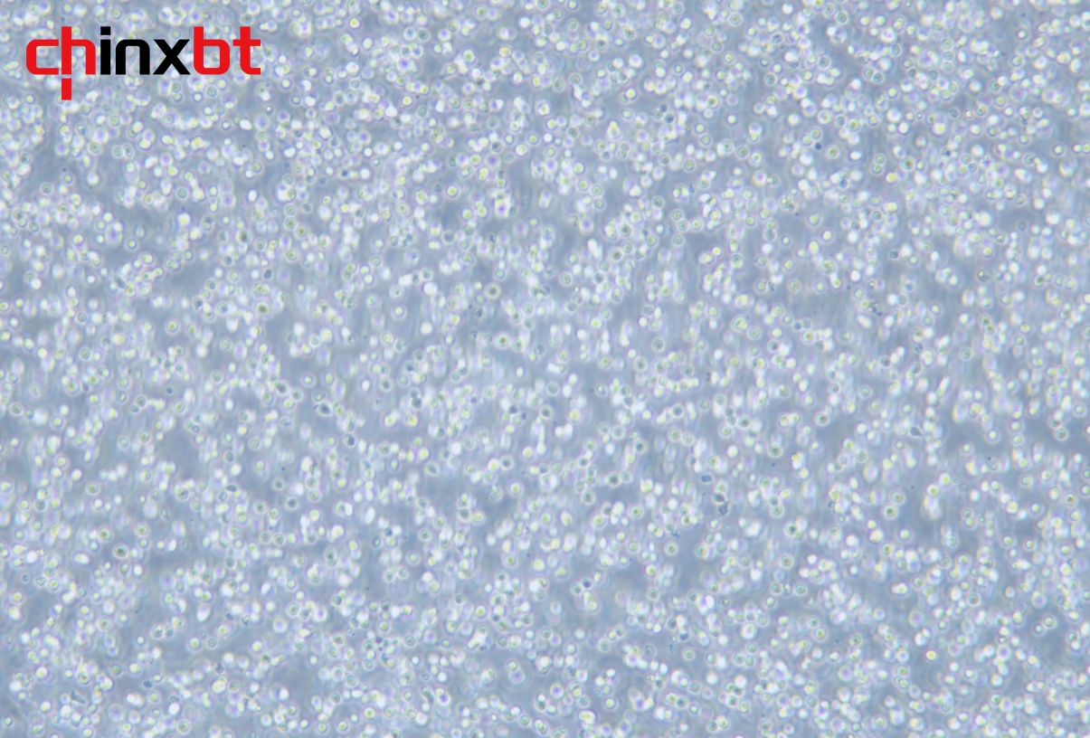 CCRF-CEM 人急性淋巴细胞白血病细胞_南京中欣博泰生物技术有限公司