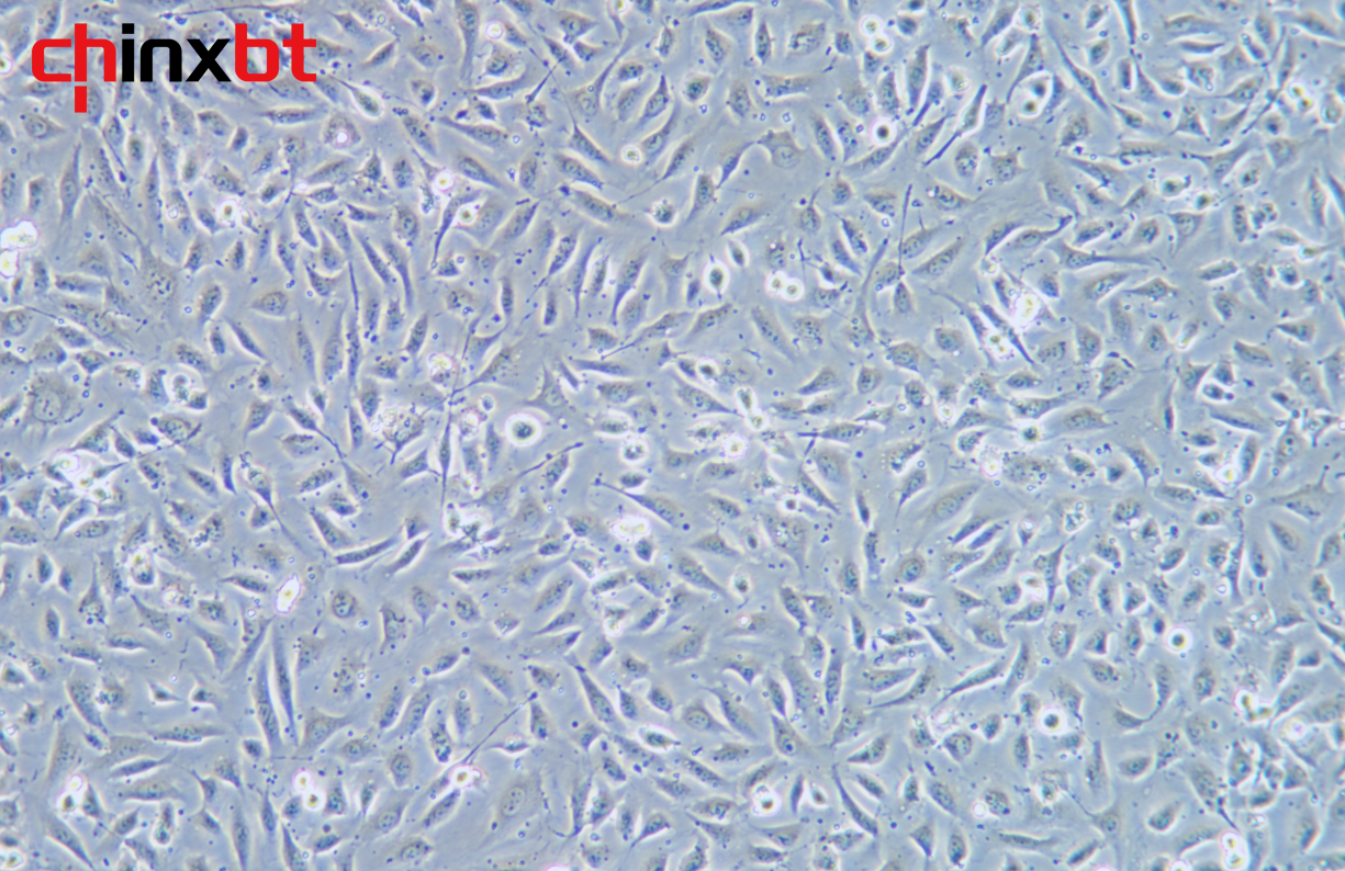 EA.hy926 人脐静脉细胞融合细胞_南京中欣博泰生物技术有限公司