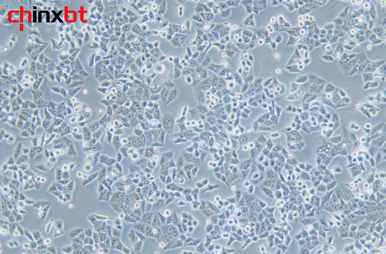 GS-HEPG2 人肝癌细胞亚型_南京中欣博泰生物技术有限公司