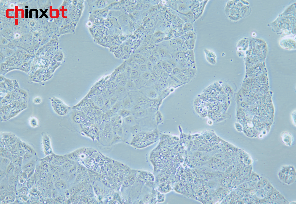 HPAF-II 人胰腺癌细胞_南京中欣博泰生物技术有限公司