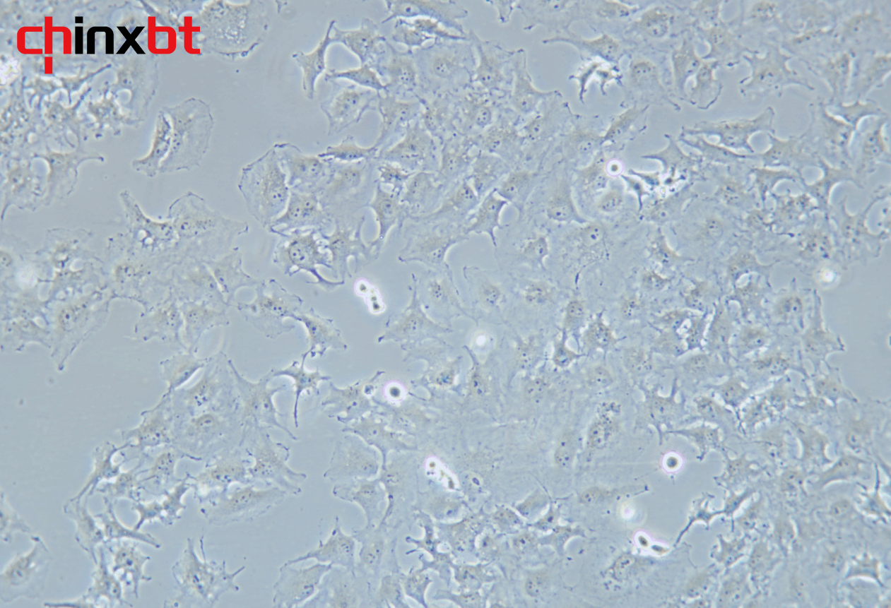 HS578T 人乳腺癌细胞_南京中欣博泰生物技术有限公司