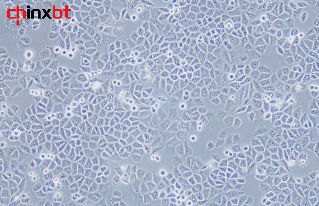 IOSE-80 人正常卵巢上皮细胞_南京中欣博泰生物技术有限公司