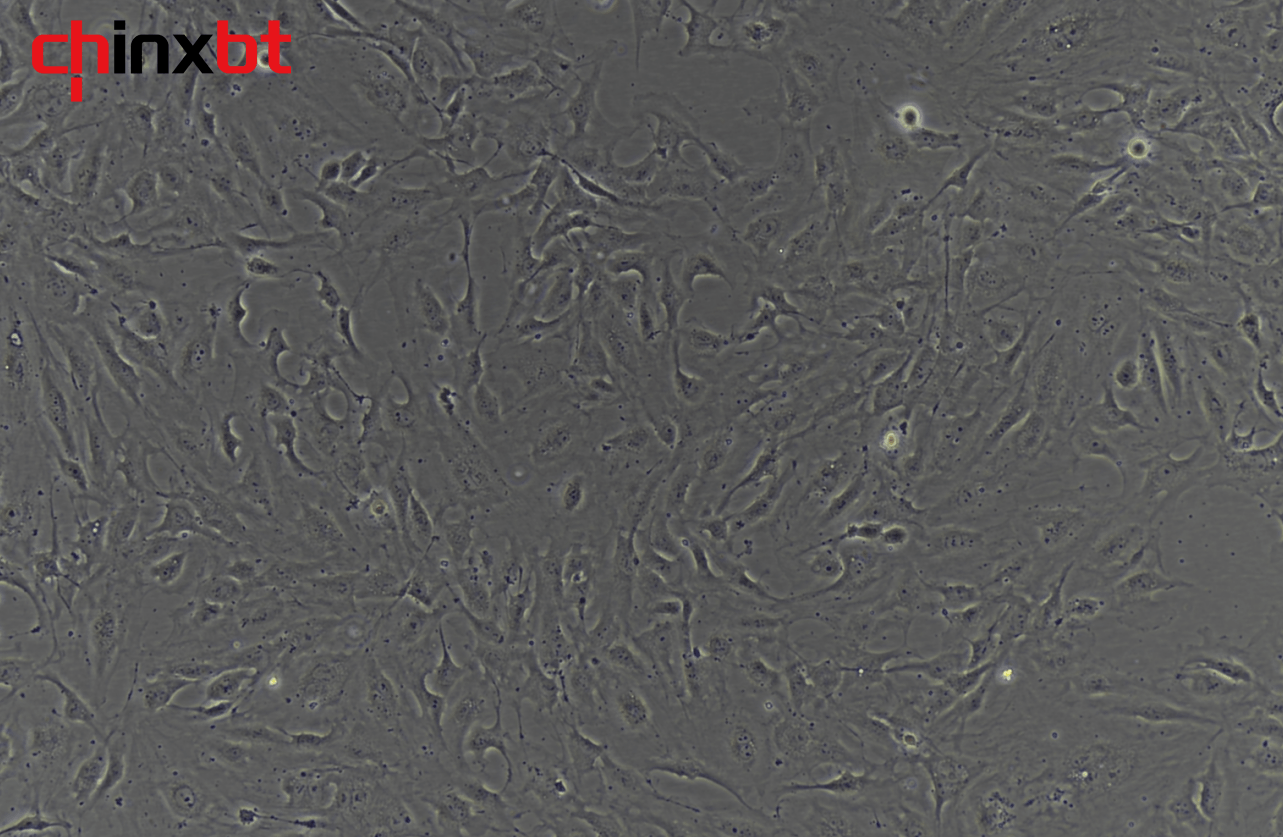 HUVEC+GFP 人脐静脉内皮细胞永生化+GFP_南京中欣博泰生物技术有限公司