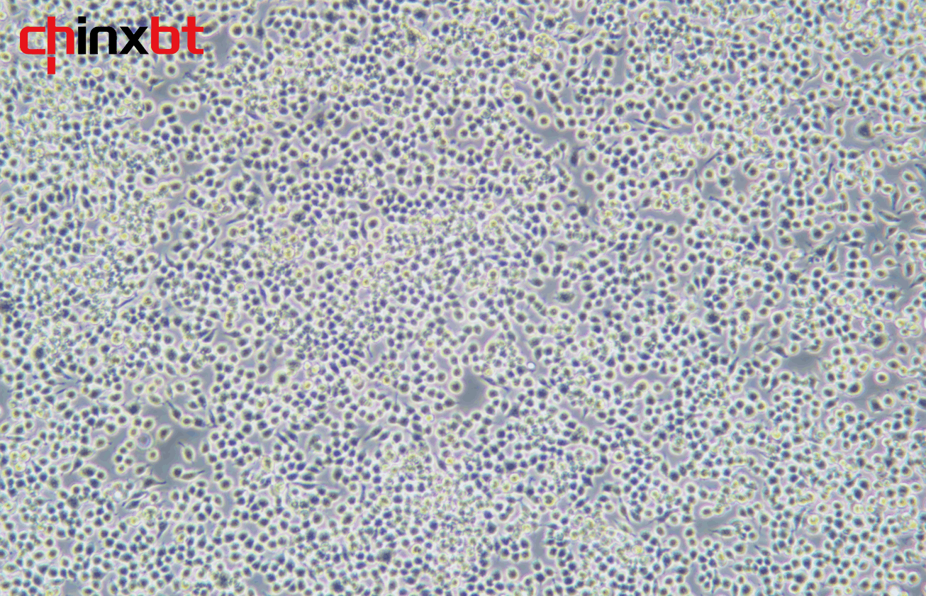 J774A.1 小鼠单核巨噬细胞_南京中欣博泰生物技术有限公司