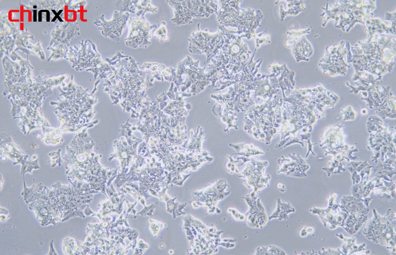 LS1034 人结肠腺癌细胞_南京中欣博泰生物技术有限公司