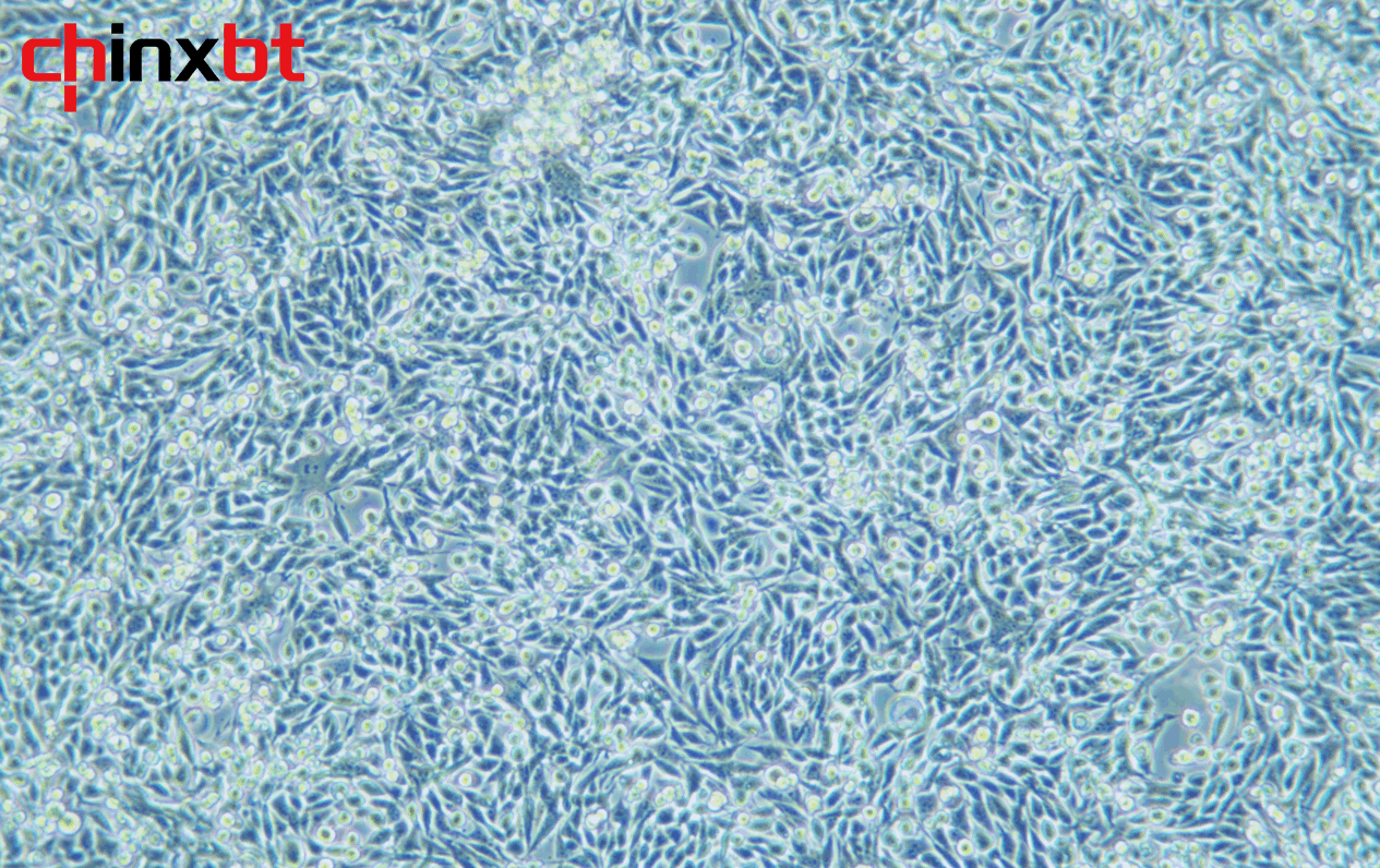 MB49+luc 小鼠膀胱癌细胞稳定表达荧光素酶_南京中欣博泰生物技术有限公司
