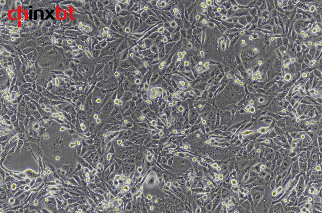 MDA-MB-231+luc 人乳腺癌细胞+luc_南京中欣博泰生物技术有限公司