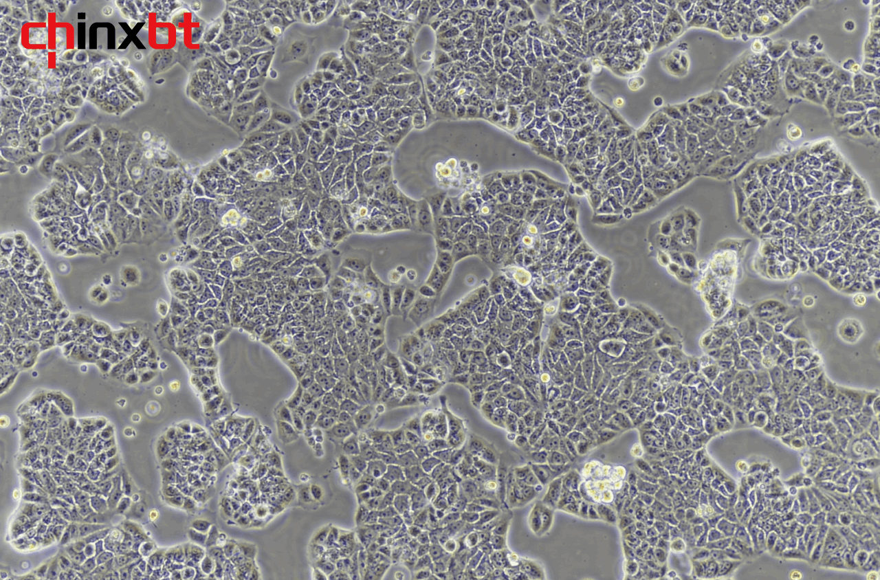 MCF-7+luc 人乳腺癌细胞+luc_南京中欣博泰生物技术有限公司
