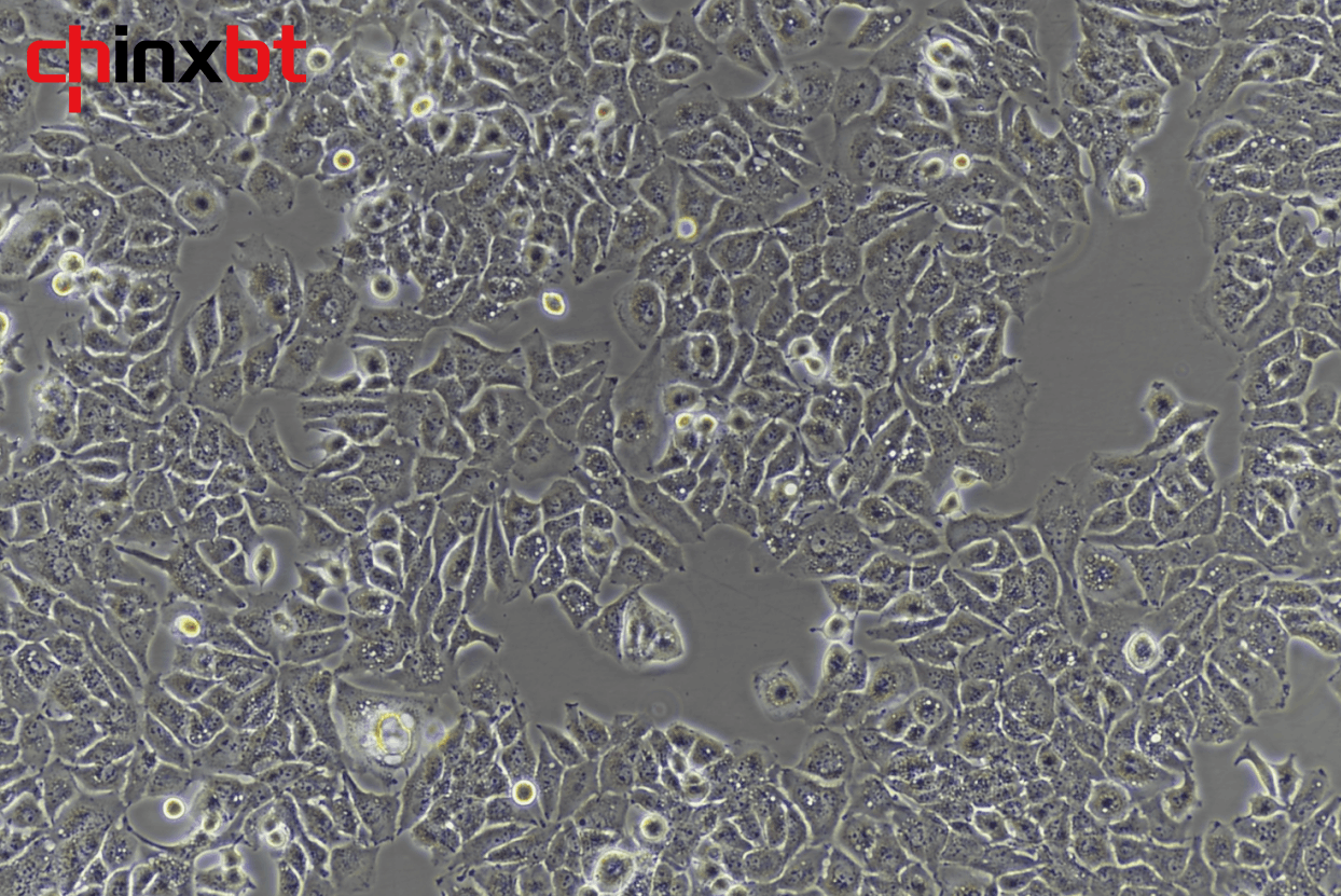 MHCC-97H+luc 人高转移潜能肝癌细胞荧光素酶标记_南京中欣博泰生物技术有限公司