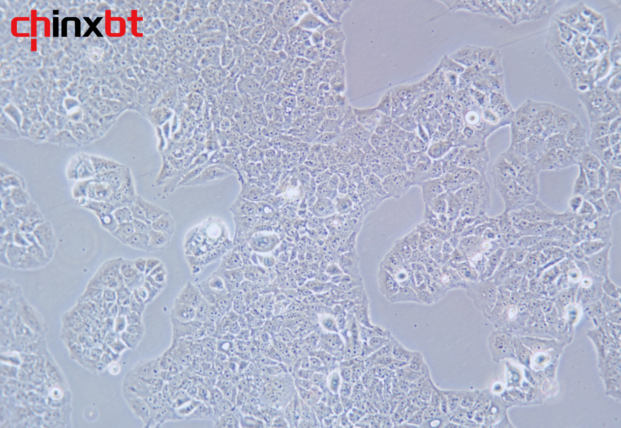 MS751 人子宫颈表皮癌细胞_南京中欣博泰生物技术有限公司