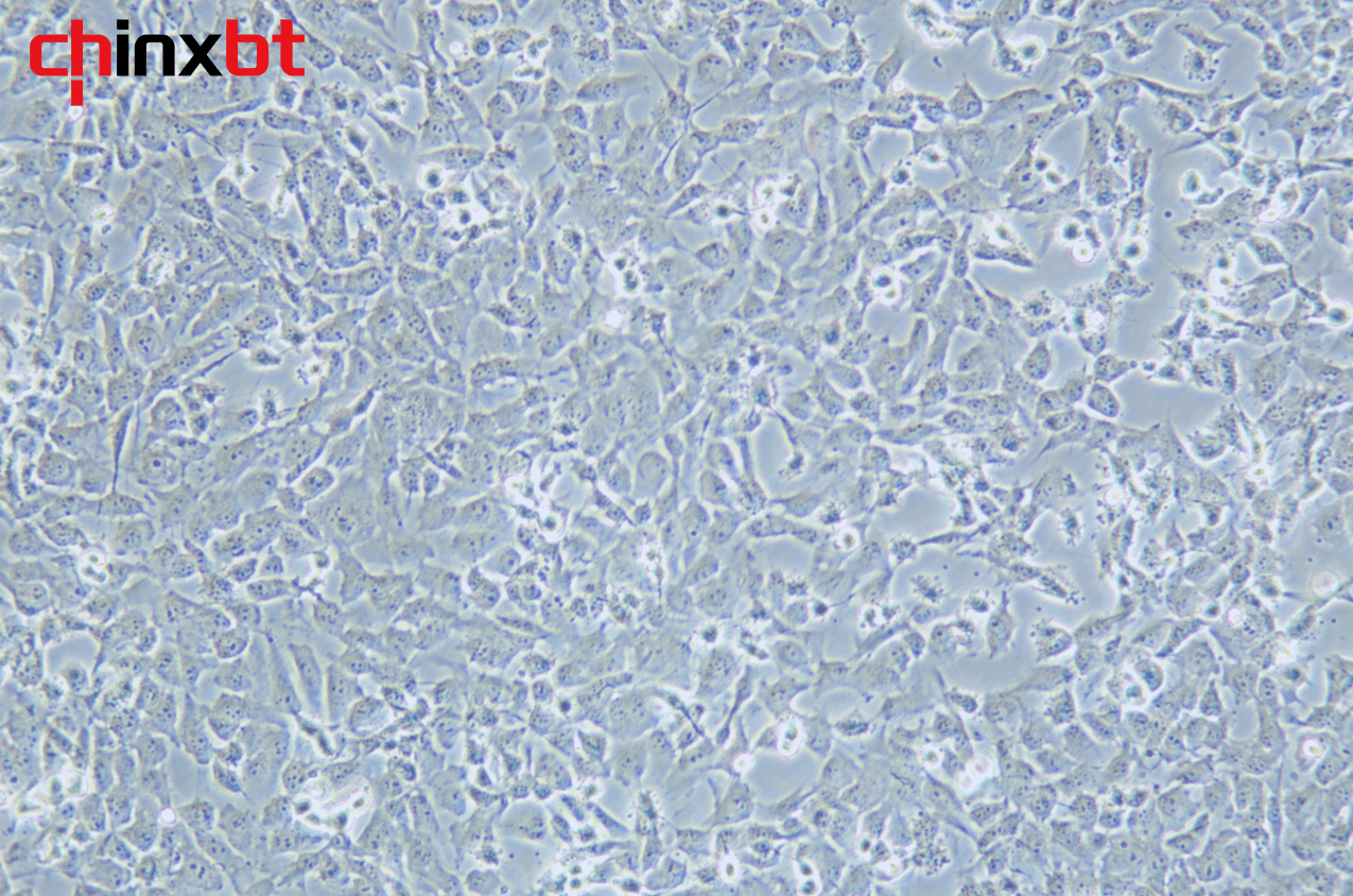 MUM2B 人侵袭性脉络膜黑色素瘤细胞_南京中欣博泰生物技术有限公司