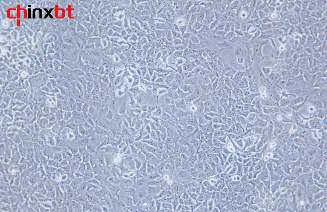 NCI-H1975 人肺腺癌细胞_南京中欣博泰生物技术有限公司