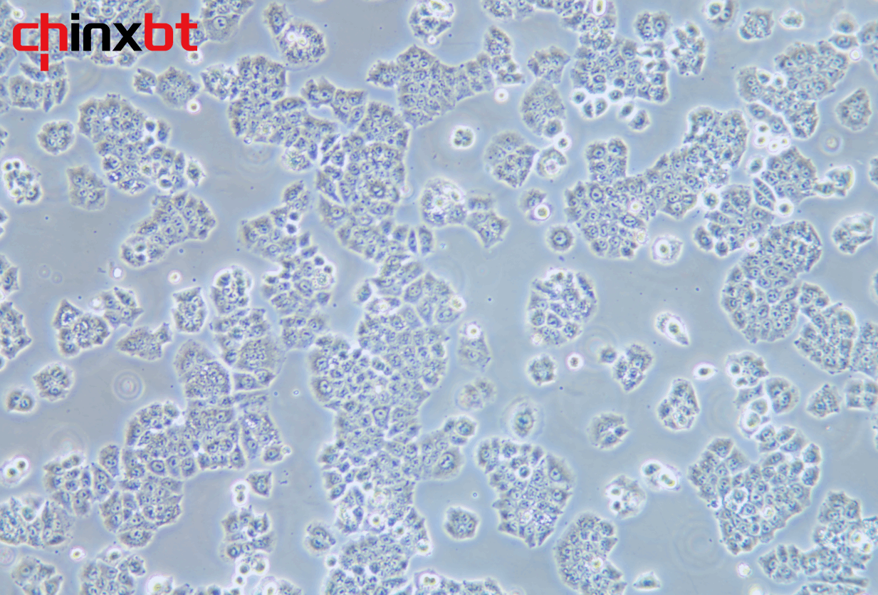 NCI-H460 人大细胞肺癌细胞_南京中欣博泰生物技术有限公司
