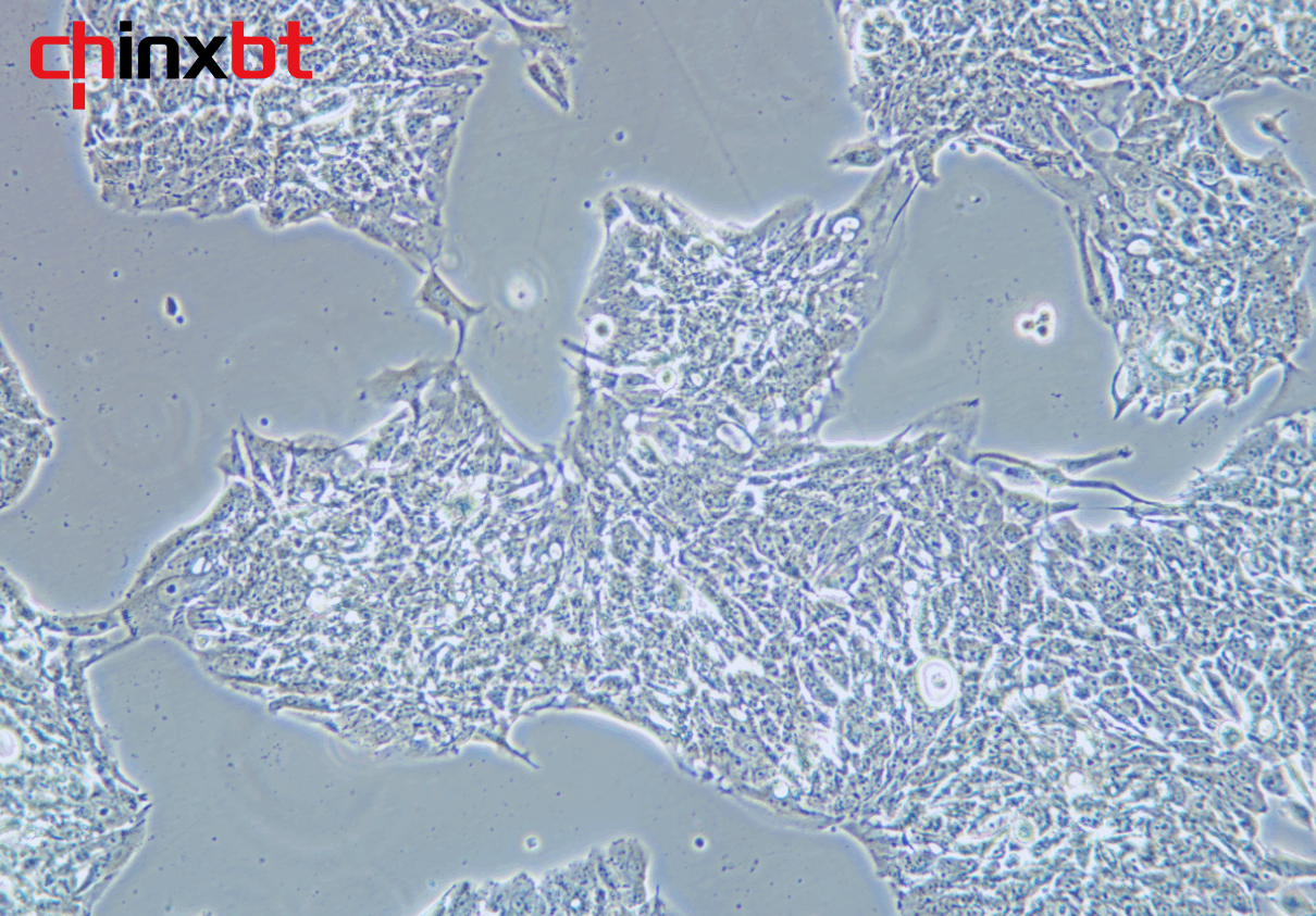 NCI-H358 人非小细胞肺癌细胞_南京中欣博泰生物技术有限公司