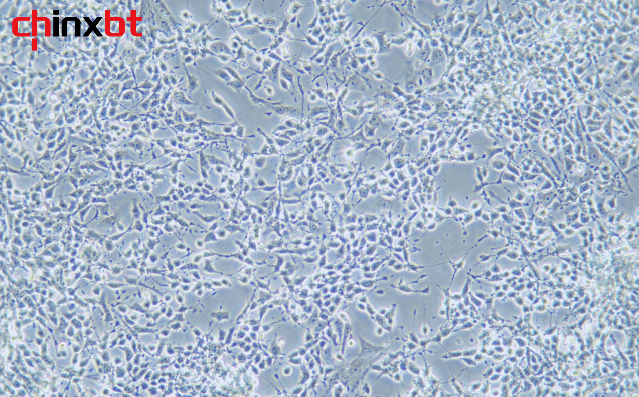 NCI-H446 人小细胞肺癌细胞_南京中欣博泰生物技术有限公司