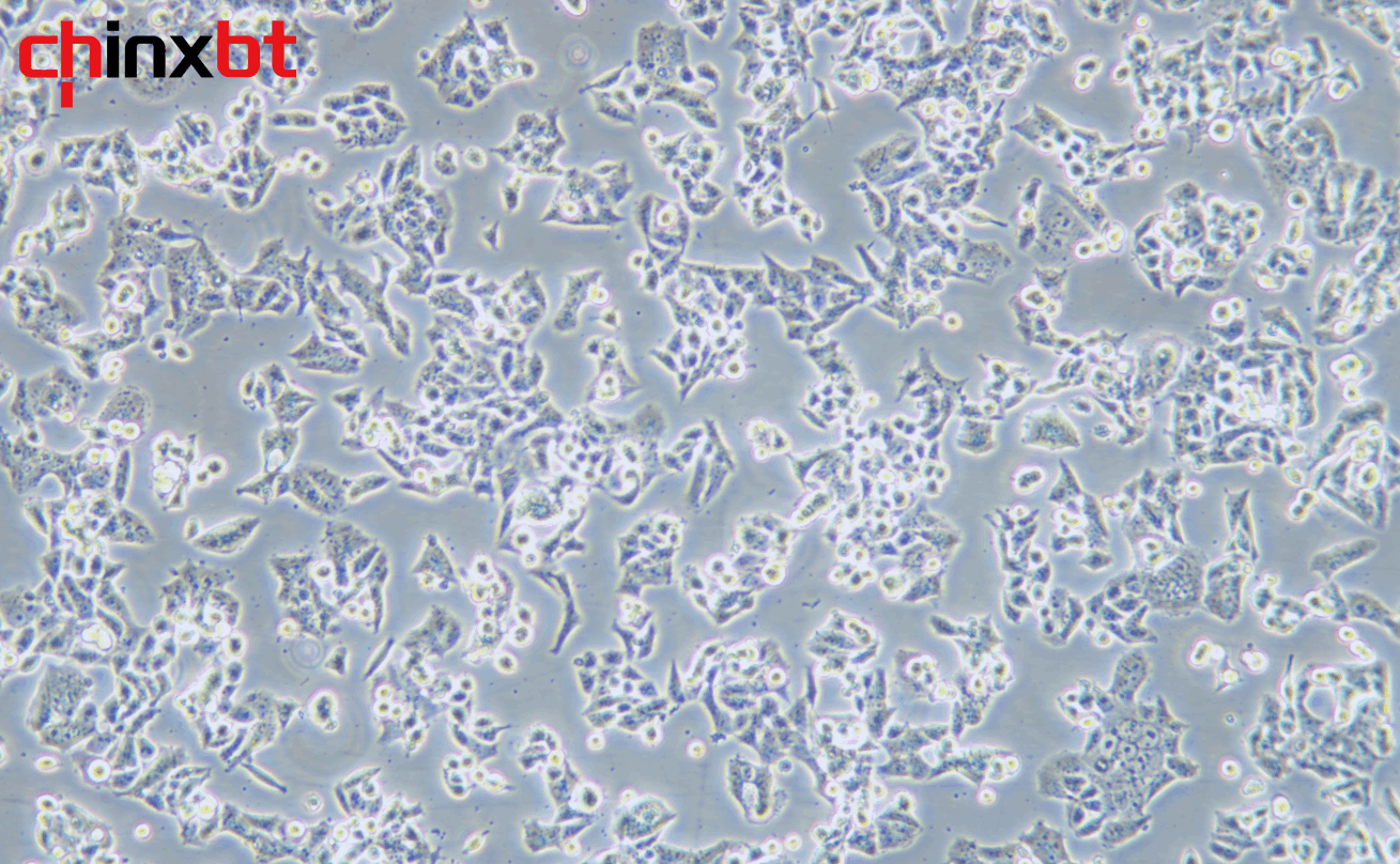 NCI-H520人肺鳞癌细胞_南京中欣博泰生物技术有限公司