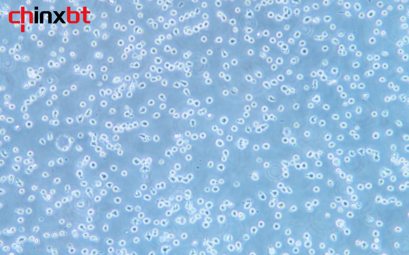 NCI-H929 人骨髓瘤细胞_南京中欣博泰生物技术有限公司 H929