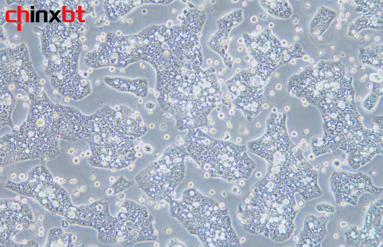 NCI-N87 人胃癌细胞_南京中欣博泰生物技术有限公司