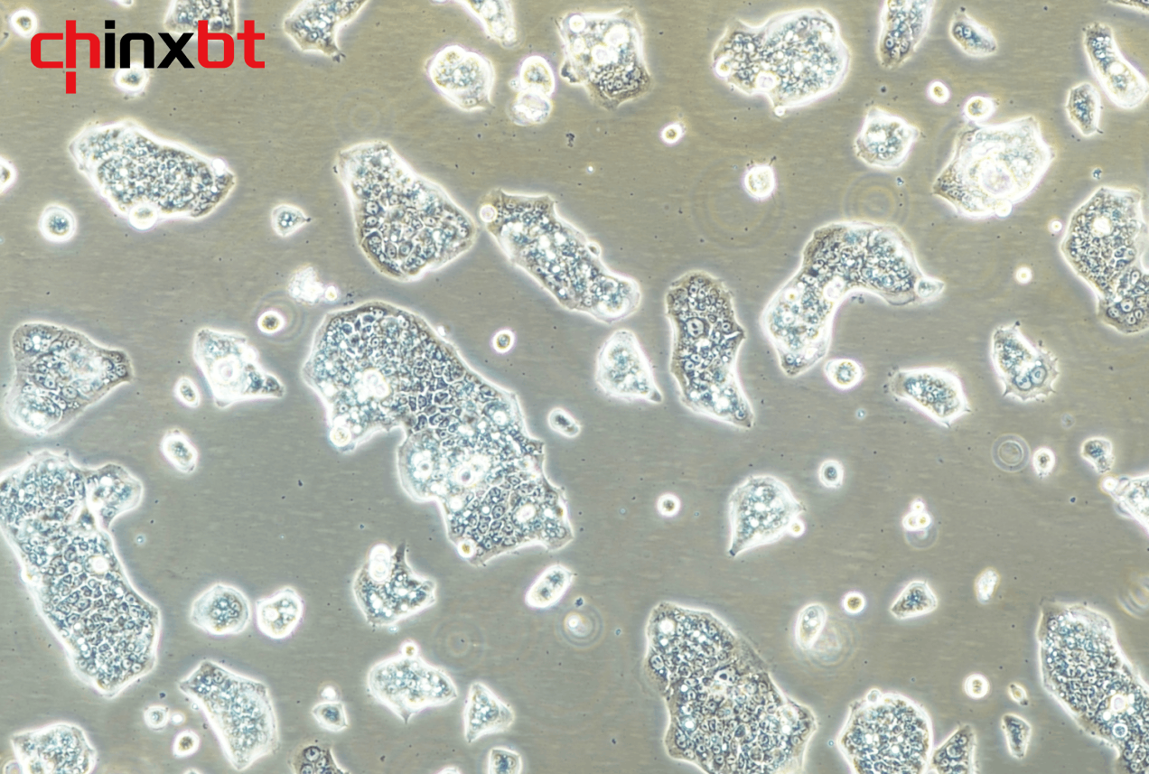NCI-N87+luc 人胃癌细胞荧光素酶标记_南京中欣博泰生物技术有限公司