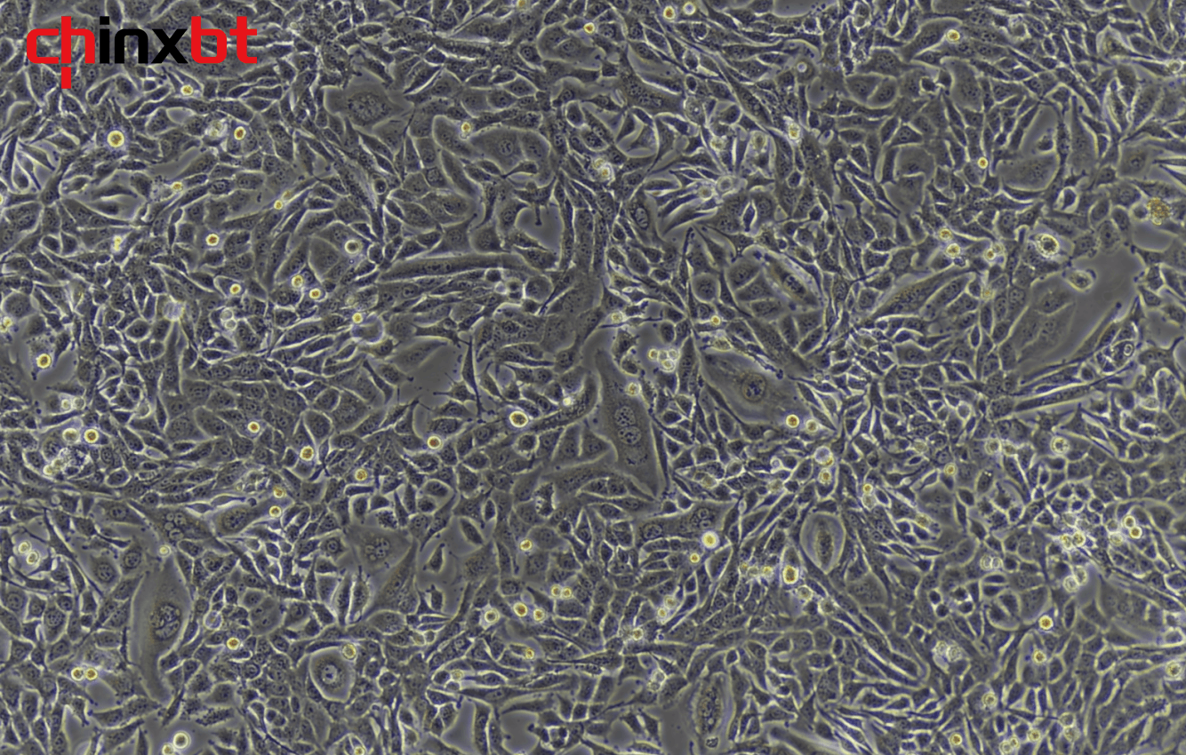 PANC02+luc 小鼠胰腺癌细胞(荧光素酶标记)_南京中欣博泰生物技术有限公司