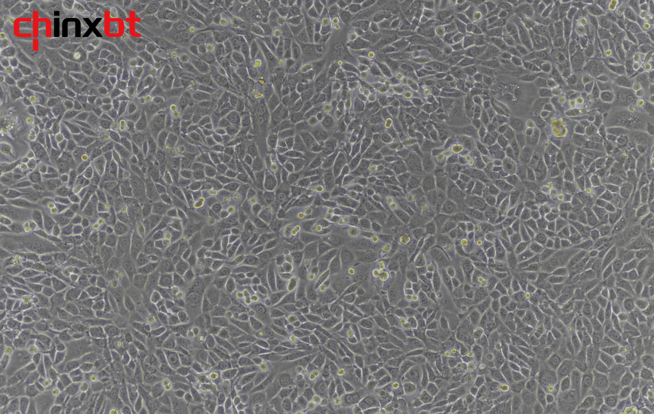 ID8+luc 小鼠卵巢上皮癌细胞+luc_南京中欣博泰生物技术有限公司