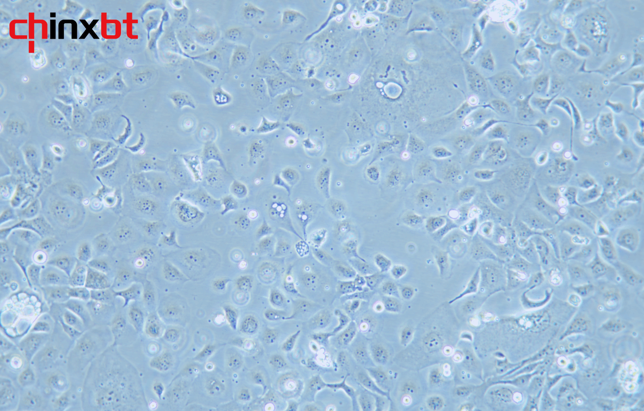 HCC1937 人乳腺癌细胞_南京中欣博泰生物技术有限公司
