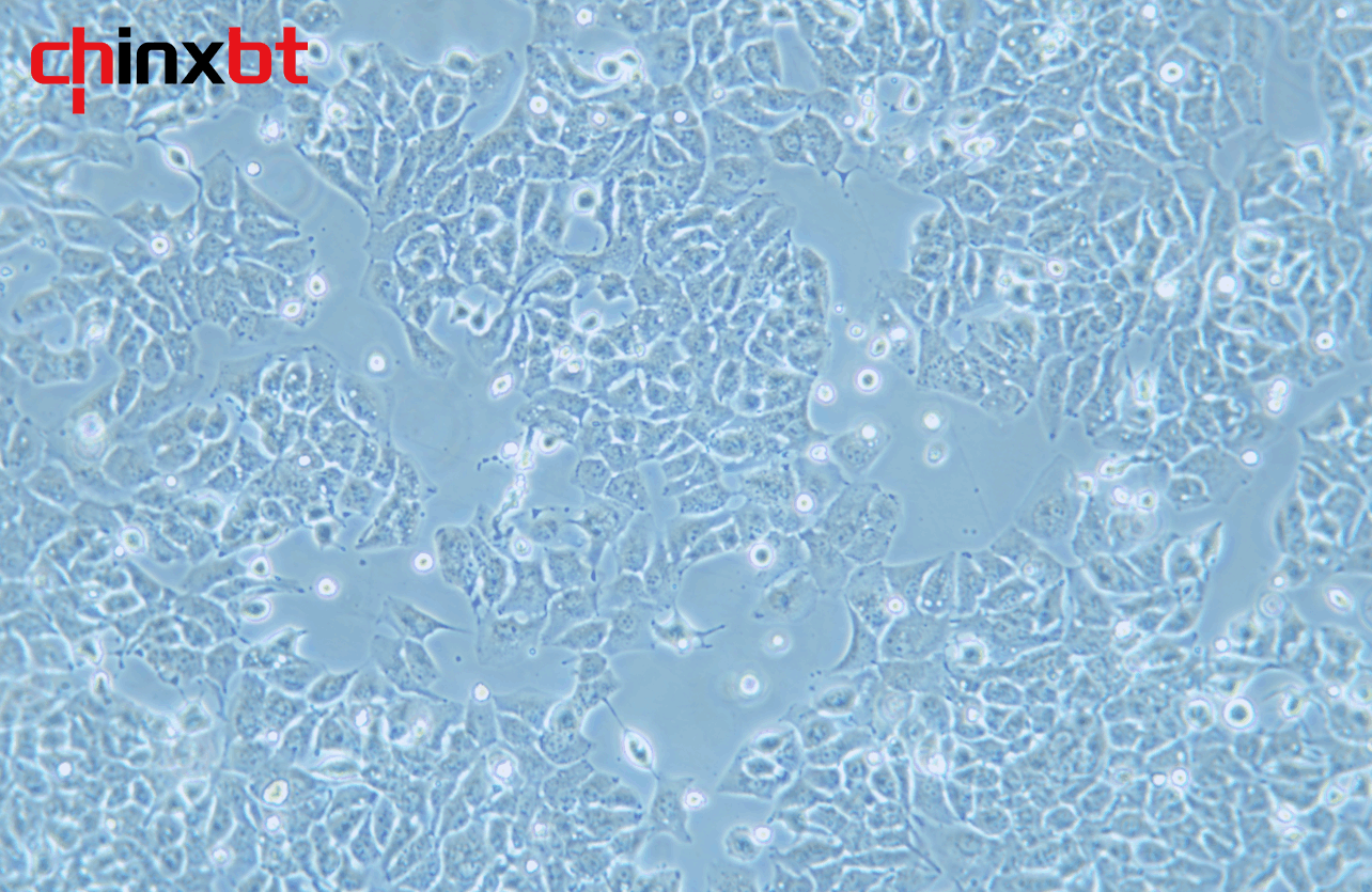 HCC-LM3 高转移人肝癌细胞_南京中欣博泰生物技术有限公司