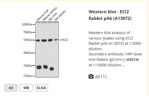 ECI2 Rabbit pAb (AX13072)_南京中欣博泰生物技术有限公司
