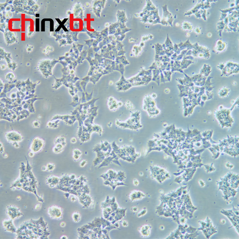 SK-N-MC 人神经上皮瘤细胞(STR鉴定)_南京中欣博泰生物技术有限公司