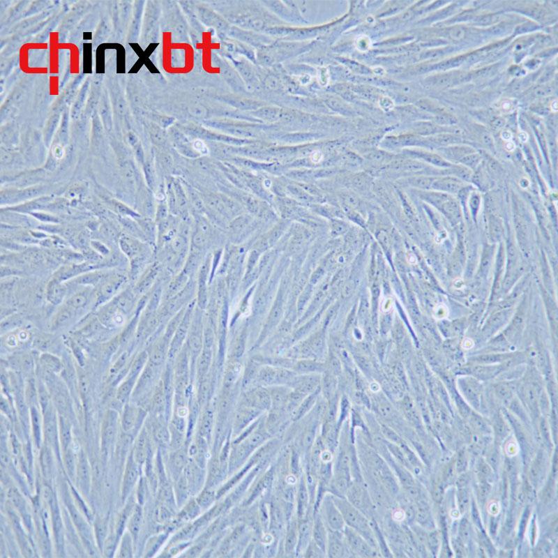 SK-N-SH 人神经母细胞瘤细胞(STR鉴定)_南京中欣博泰生物技术有限公司
