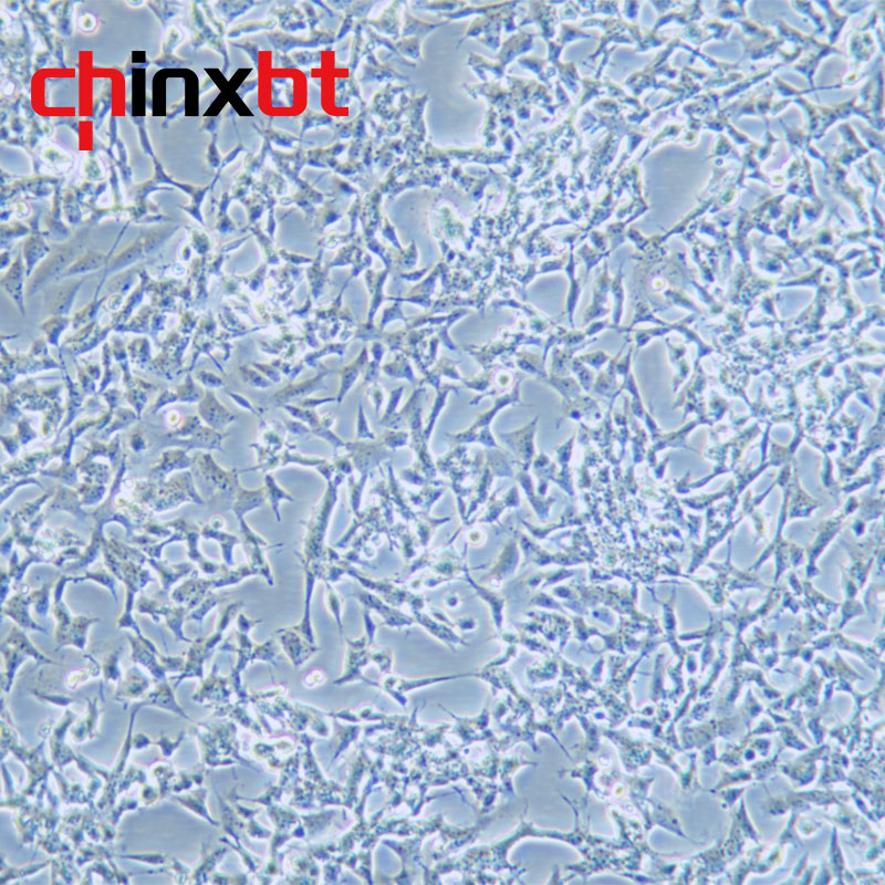 SK-N-BE(2)人神经母细胞瘤细胞STR鉴定)_南京中欣博泰生物技术有限公司
