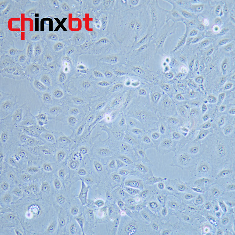SNU-182 人肝癌细胞_南京中欣博泰生物技术有限公司