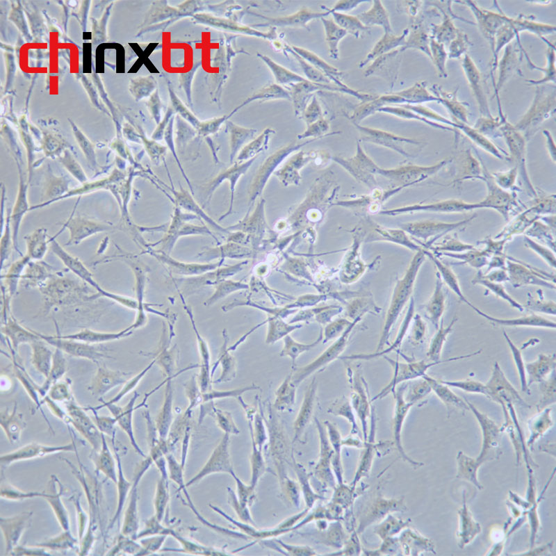 U118MG 人脑星形胶质母细胞瘤(STR鉴定)_南京中欣博泰生物技术有限公司